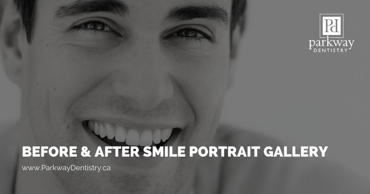 Before and After Smile Portrait Gallery - Parkway Dentistry